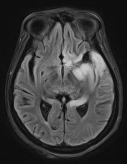 Glasp on 'UWorld USMLE' | Glasp