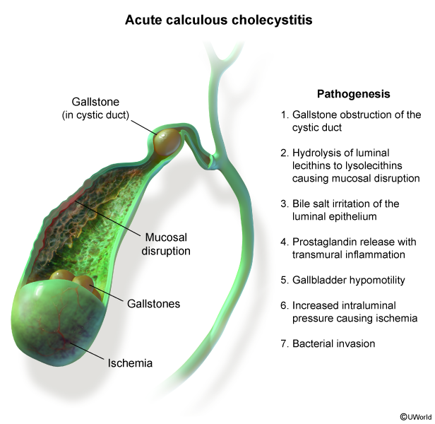 [nclex] Gastrointestinal disorder : 네이버 블로그